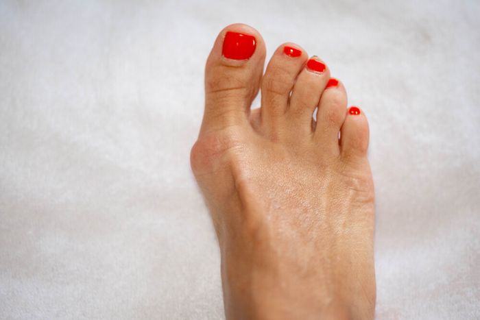 Red Toes Symptoms